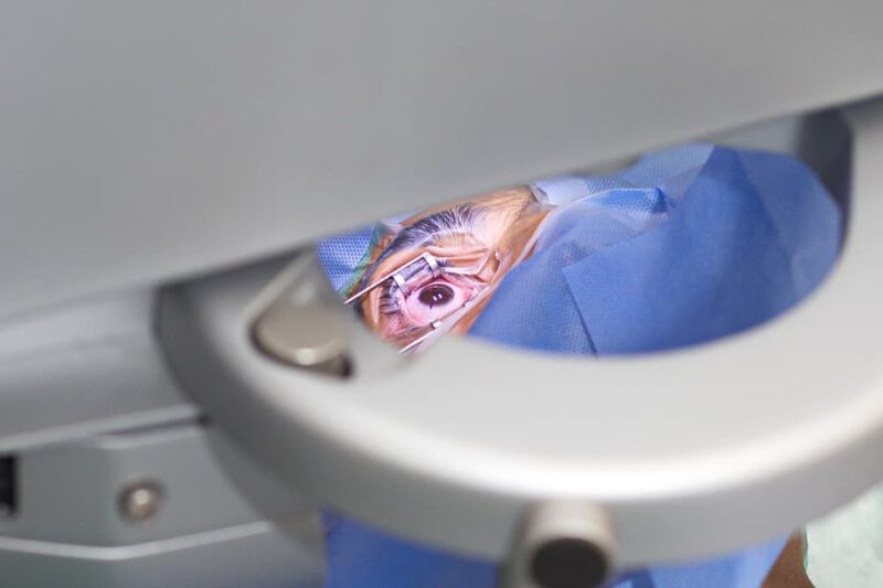 LASIK vs Laser Eye Surgery: Exploring Key Differences