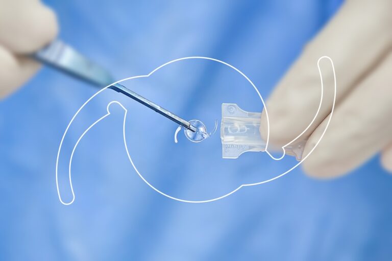 Basics of IOL: What are IOLs? | Eye Care Professionals