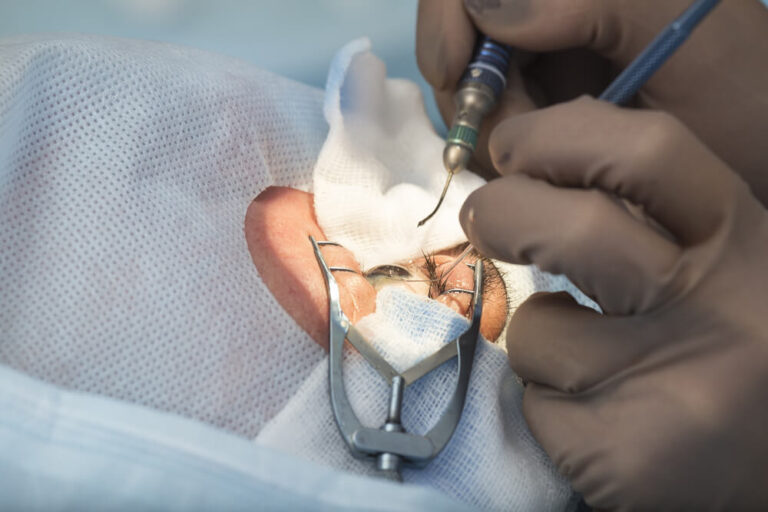 Post-Operative Care for Intraocular Lens Implants Patients